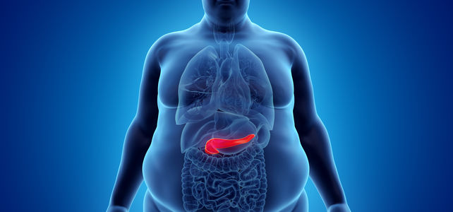 Sindrome metabolica e cancro al pancreas